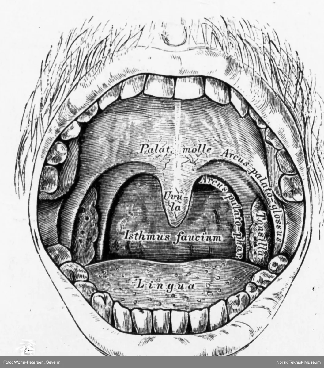 Anatomi - kjæve - Tandlæge Eyde-Evensen - Norsk Teknisk Museum ...